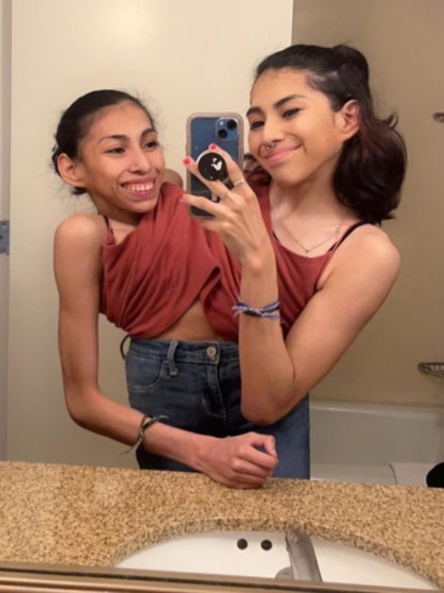 Conheça as gêmeas siamesas de 22 anos que são sucesso no TikTok | Web ...