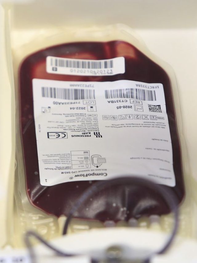 PEC do Plasma prevê venda de parte do sangue humano | Web Stories CNN ...