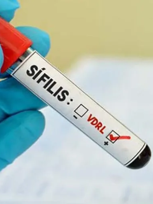 Buscas por “sífilis congênita” têm pico em outubro; saiba o que é | Web ...