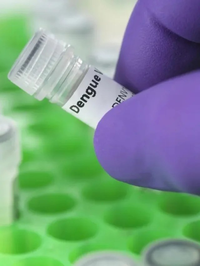 Teste de dengue: veja as opções e quando deve ser feito | Web Stories ...