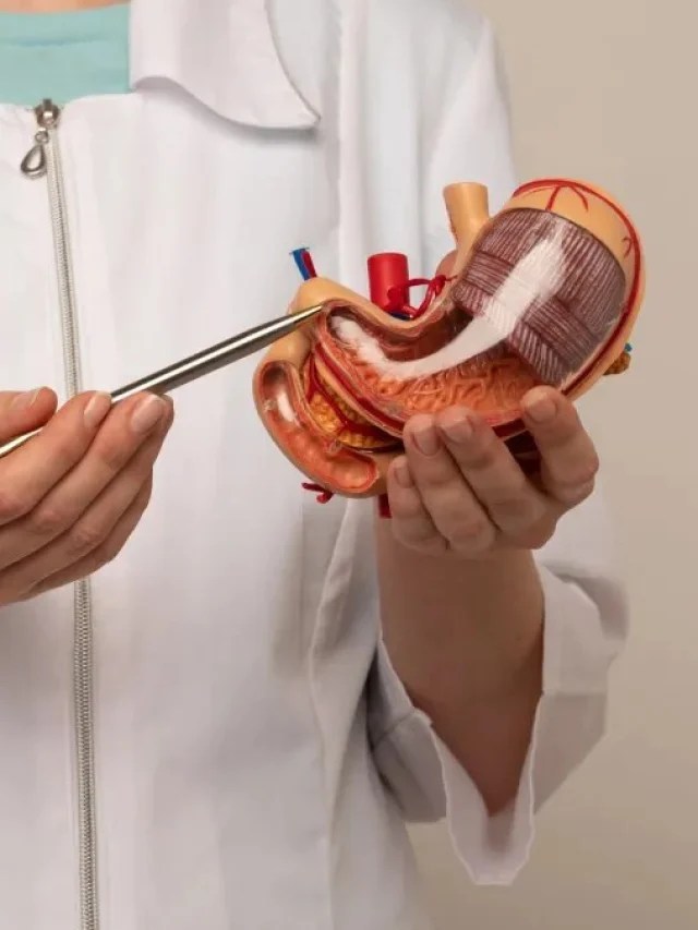 Balão intragástrico: como funciona e para quem é indicado? | Web ...