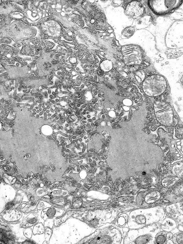 Quais as complicações da raiva humana e por que é tão letal? | Web ...